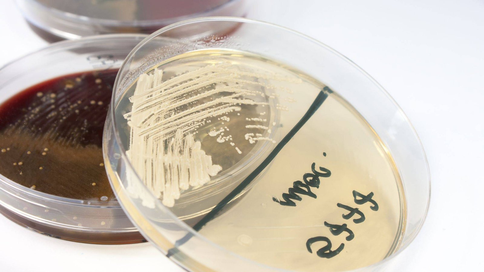 What Does Candida Overgrowth Look Like?